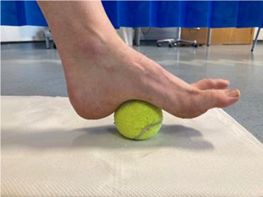 Painful Big Toe Joint (Hallux Limitus/Rigidus) Patient Information ...